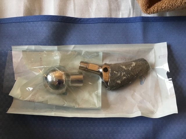 脚延長手術フェーズ2 術後12日 レントゲン: グリーゼ581h