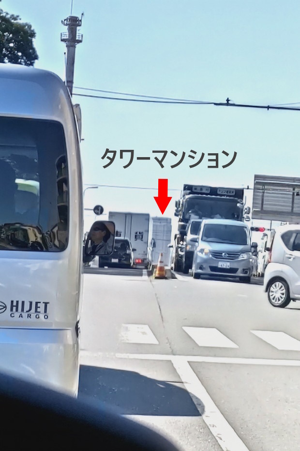 脚延長手術フェーズ2 大腿骨転子部骨折 CT検査: グリーゼ581h