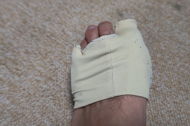 【歩行リハ】杖＋GSD 1回目 残る大きな問題はアロディニア: グリーゼ581h