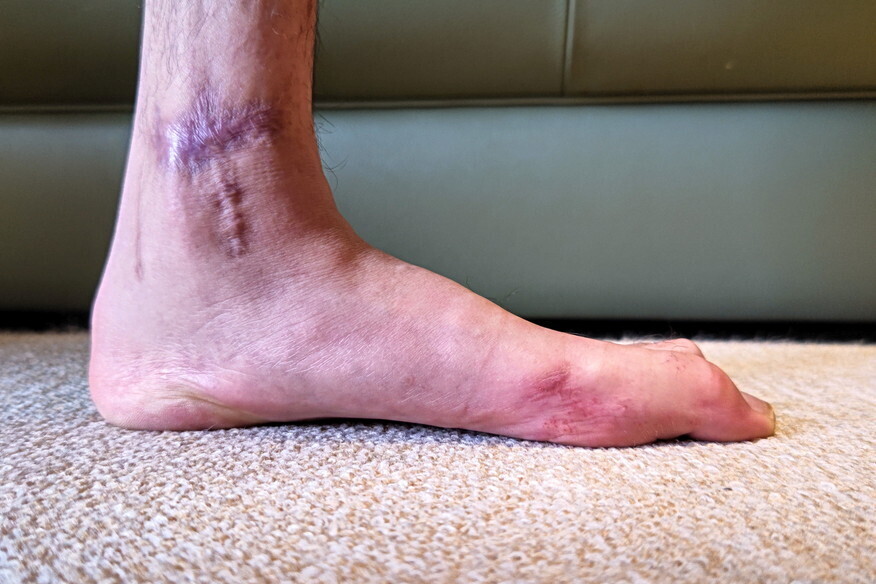 母趾球サポーターの購入履歴: グリーゼ581h