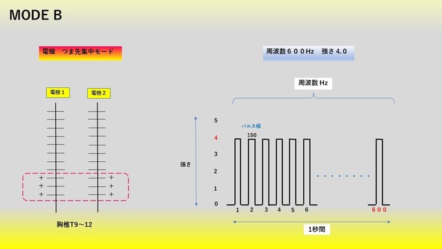 SCS脊髄刺激装置埋込み患者 MRI 受け入れ先病院を探すのは一苦労: グリーゼ581h